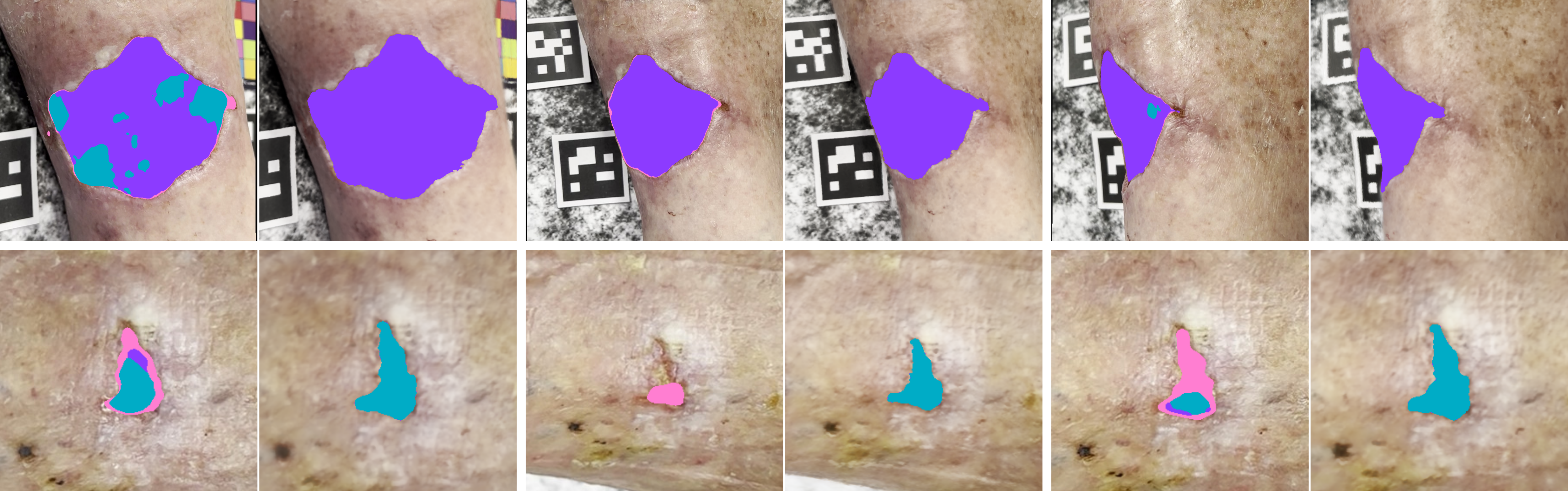 WoundNeRF: Multi-View Consistent Wound Segmentation With Neural Fields ...